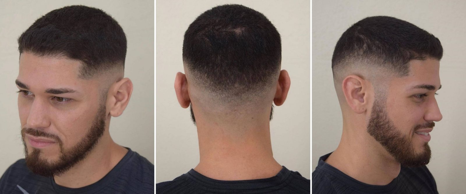 50+ Undercut Haircut Super Stylish Variations for Men